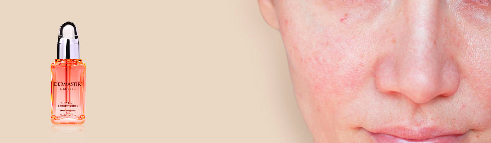 Sensitive skin & Anti-redness treatment – Dermastir